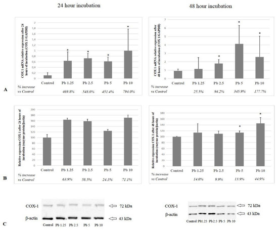 IJMS | Special Issue : Molecular Mechanisms of Lead Neurotoxicity