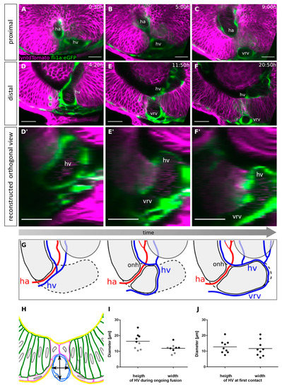 In Vivo Analysis of Optic Fissure Fusion in Zebrafish: Pioneer Cells ...
