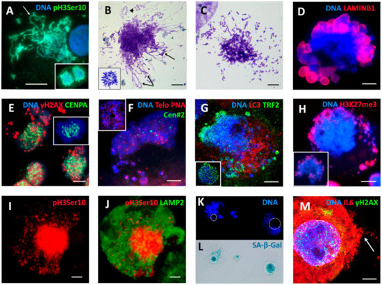 “Mitotic Slippage” and Extranuclear DNA in Cancer Chemoresistance: A ...