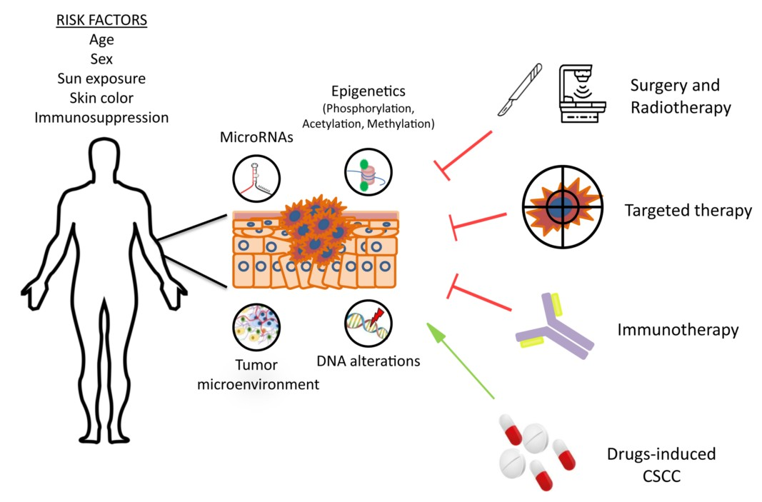 IJMS | Free Full-Text | Cutaneous Squamous Cell Carcinoma: From Biology ...