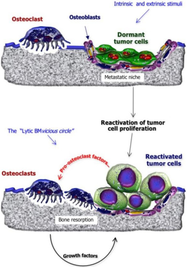 IJMS | Free Full-Text | Role of Bone Targeting Agents in the Prevention ...