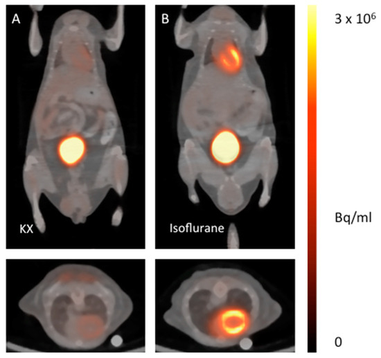 18F-FDG PET-Based Imaging of Myocardial Inflammation Following Acute Myocardial Infarction in a ...