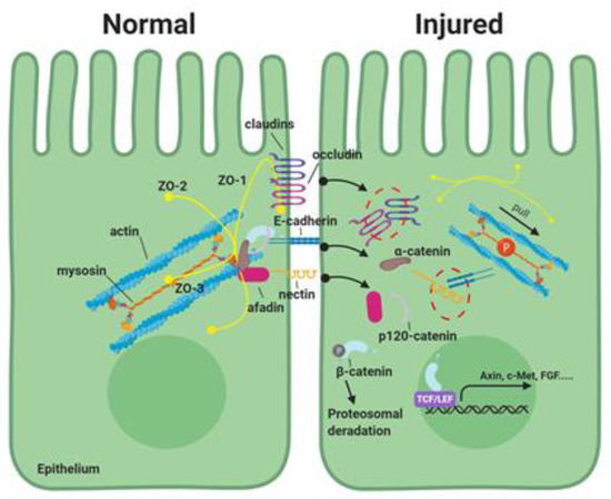 The Regulation of Intestinal Mucosal Barrier by Myosin Light Chain ...