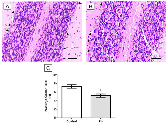 IJMS | Special Issue : Molecular Mechanisms of Lead Neurotoxicity