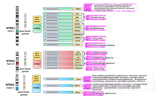 NTRK Fusions, from the Diagnostic Algorithm to Innovative Treatment in ...