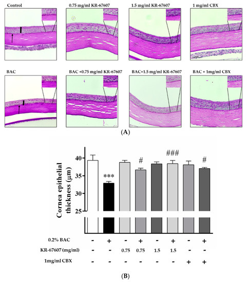 A Novel Selective 11β-HSD1 Inhibitor, (E)-4-(2-(6-(2,6-Dichloro-4-(Trifluoromethyl)Phenyl)-4 ...