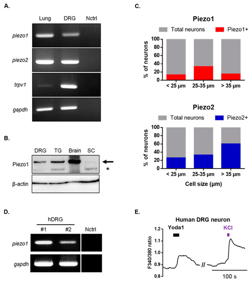 Functional Expression of Piezo1 in Dorsal Root Ganglion (DRG) Neurons