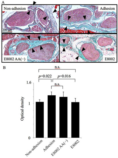 E8002 Inhibits Peripheral Nerve Adhesion by Enhancing Fibrinolysis of l ...