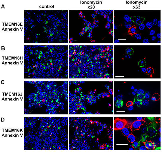 Targeting of Intracellular TMEM16 Proteins to the Plasma Membrane and ...