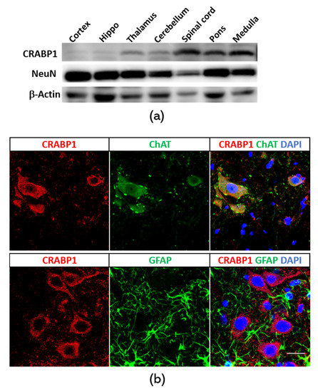 Sonic Hedgehog-Gli1 Signaling and Cellular Retinoic Acid Binding ...