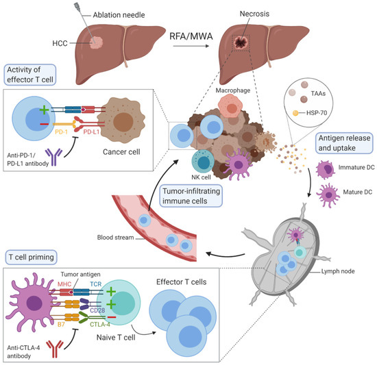 Percutaneous Ablation-Induced Immunomodulation in Hepatocellular Carcinoma