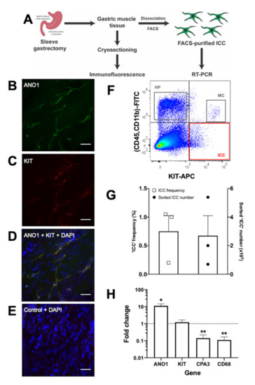 Understanding the Biology of Human Interstitial Cells of Cajal in ...