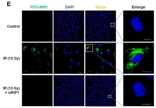 RIP1 Is a Novel Component of γ-ionizing Radiation-Induced Invasion of ...