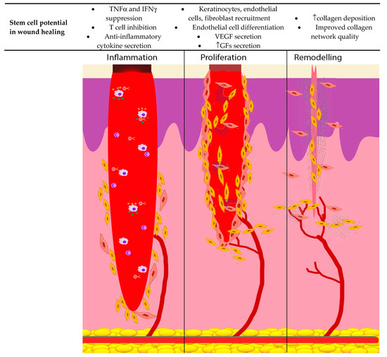 Burns in the Elderly: Potential Role of Stem Cells