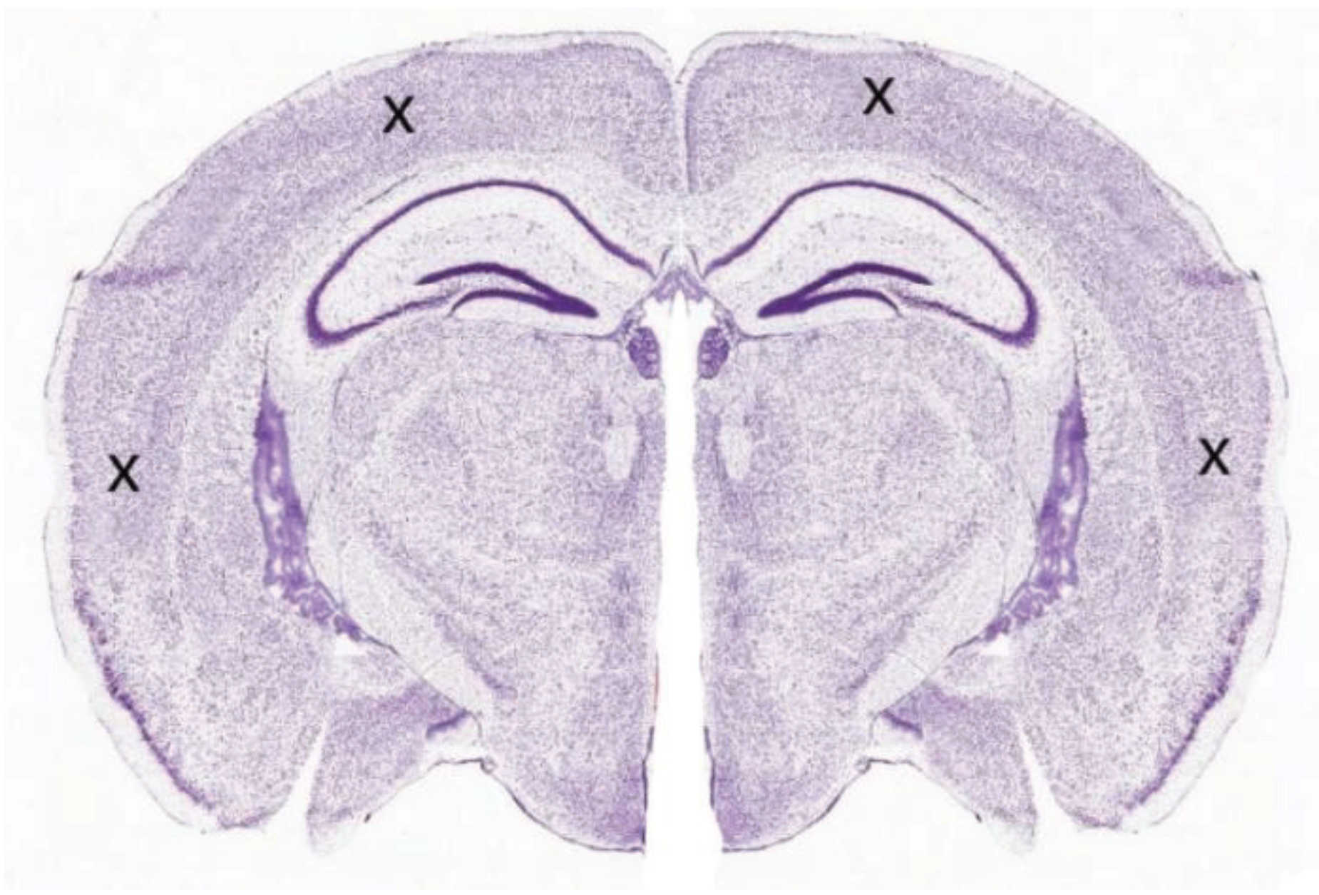 A Metabolic Mechanism for Anaesthetic Suppression of Cortical Synaptic ...