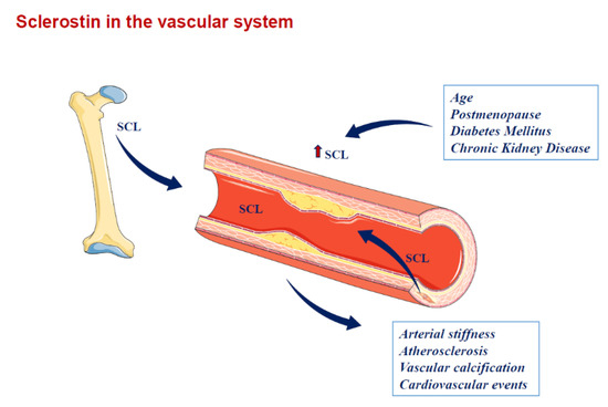 IJMS | Free Full-Text | Sclerostin and Vascular Pathophysiology