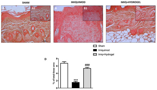 Topical Delivery of Curcumin by Choline-Calix[4]arene-Based ...