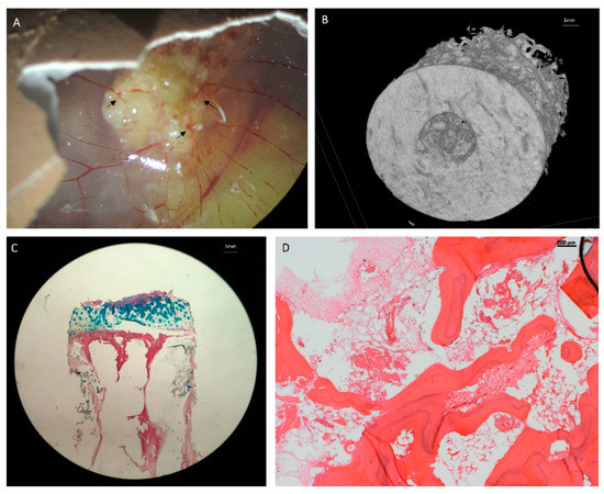 The Role of Pre-Clinical 3-Dimensional Models of Osteosarcoma