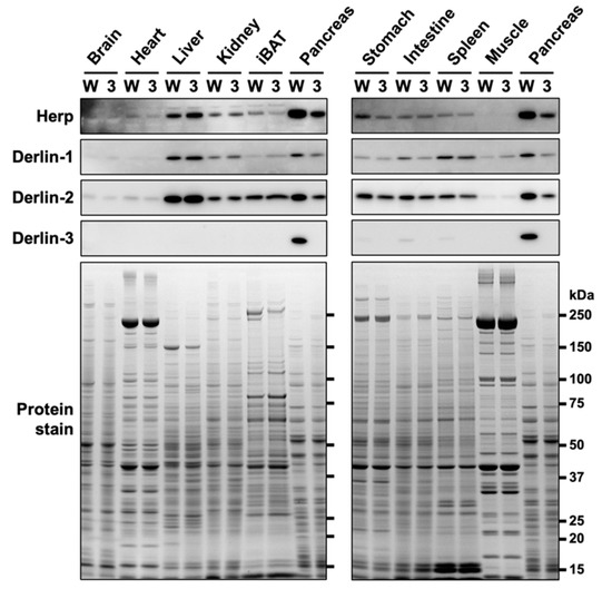 Derlin-3 Is Required for Changes in ERAD Complex Formation under ER Stress