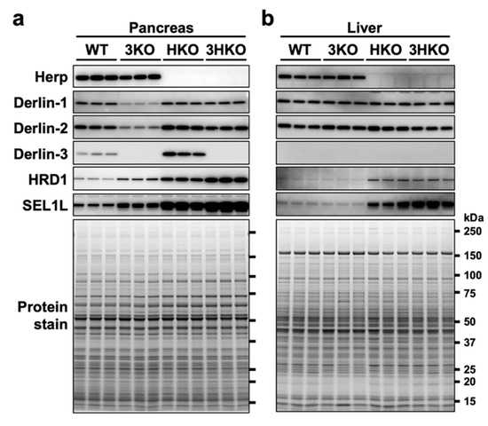 Derlin-3 Is Required for Changes in ERAD Complex Formation under ER Stress