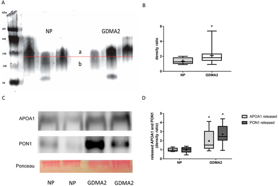 Gestational Diabetes Type 2: Variation in High-Density Lipoproteins ...