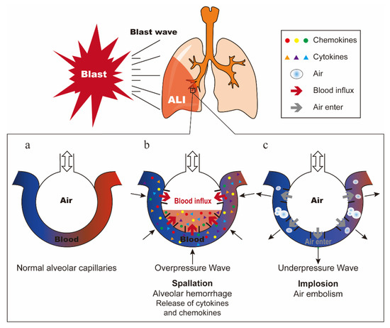 Damage-Associated Molecular Patterns and Their Signaling Pathways in Primary Blast Lung Injury ...
