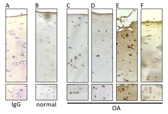The Lysine Specific Demethylase-1 Negatively Regulates the COL9A1 Gene ...
