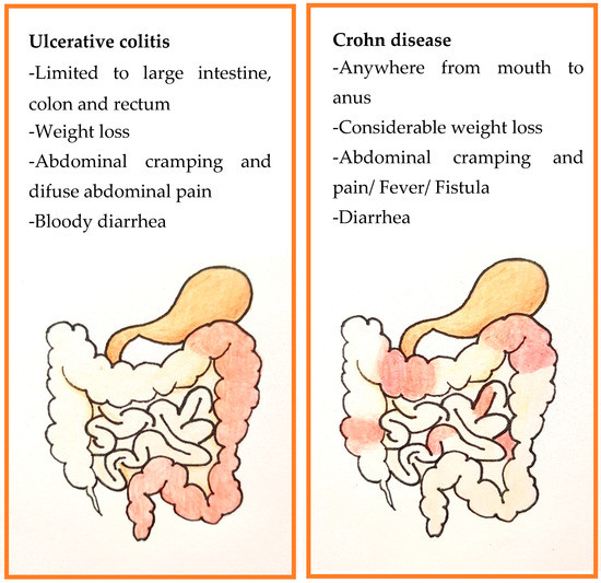 New Insights of Oral Colonic Drug Delivery Systems for Inflammatory ...