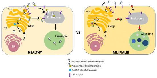 Mucolipidoses Overview: Past, Present, and Future