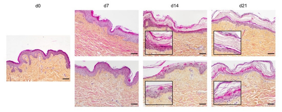 Characterization of a Topically Testable Model of Burn Injury on Human ...
