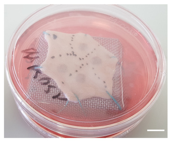 Characterization of a Topically Testable Model of Burn Injury on Human ...