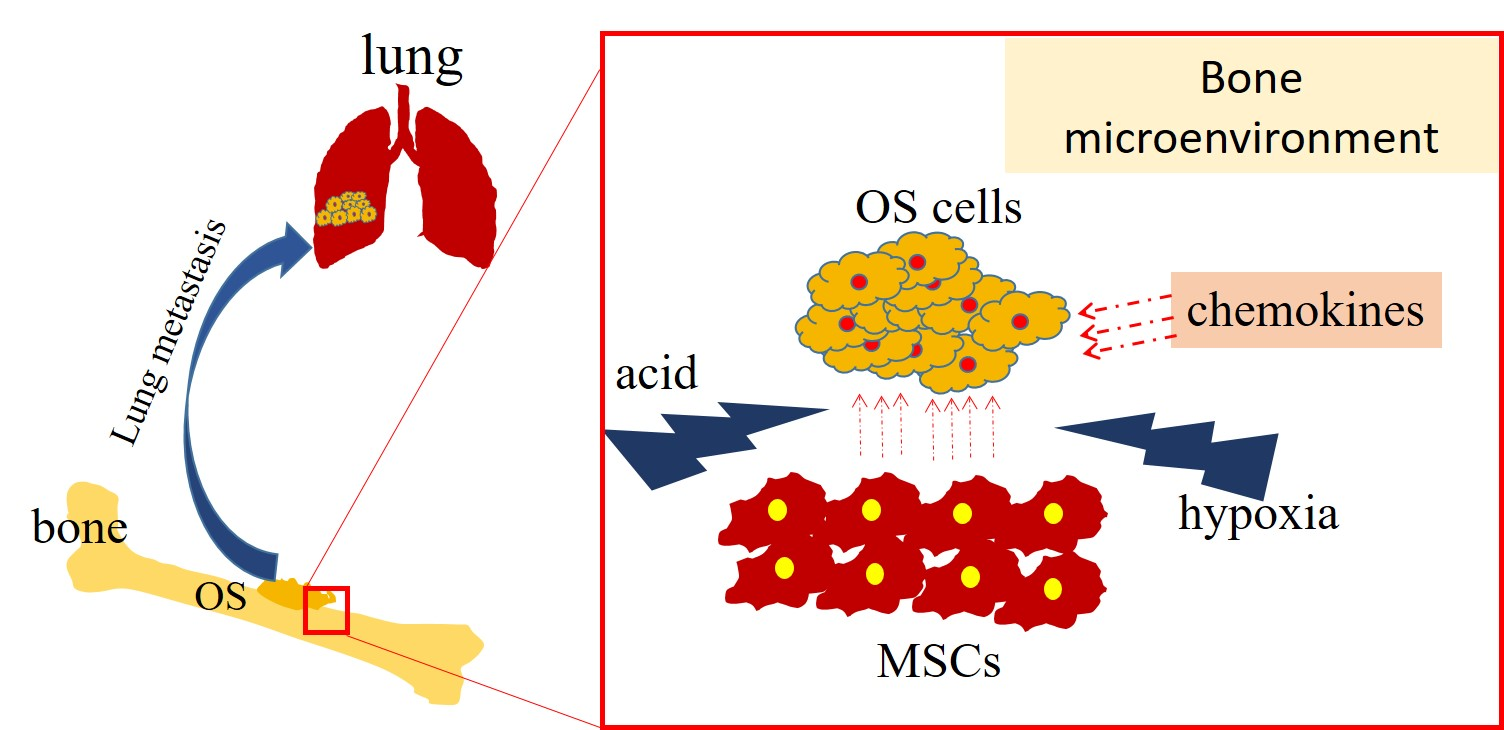 IJMS | Free Full-Text | Bone Microenvironment and Osteosarcoma Metastasis