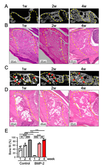 BMP-2/β-TCP Local Delivery for Bone Regeneration in MRONJ-Like Mouse Model