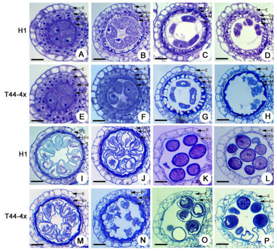Comparative Cytological and Transcriptome Analysis Revealed the Normal ...