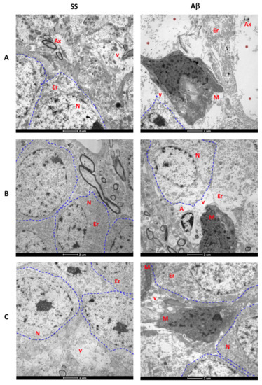 Activation of STAT3 Regulates Reactive Astrogliosis and Neuronal Death ...