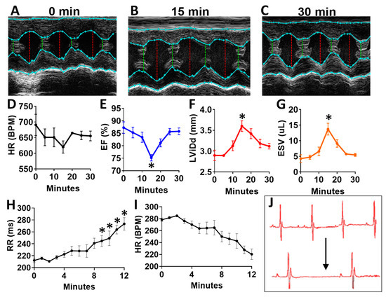 The BDNF rs6265 Polymorphism is a Modifier of Cardiomyocyte ...