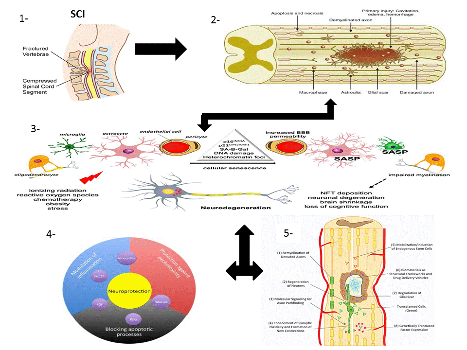 IJMS | Free Full-Text | Spinal Cord Injury: Pathophysiology ...