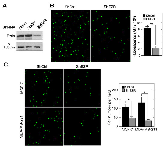 Bidirectional Tumor-Promoting Activities of Macrophage Ezrin