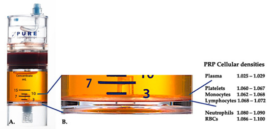 Platelet-Rich Plasma: New Performance Understandings and Therapeutic ...