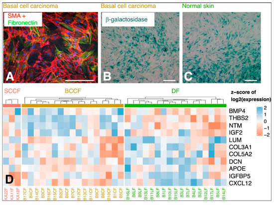 Interleukin-6: Molecule in the Intersection of Cancer, Ageing and COVID-19
