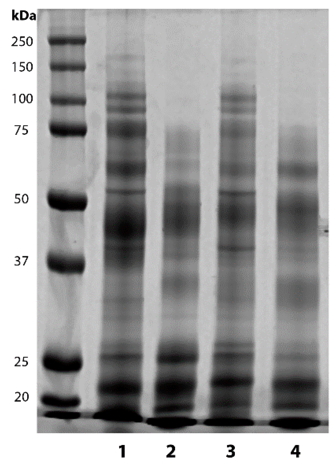 Vasectomy and Photoperiodic Regimen Modify the Protein Profile ...