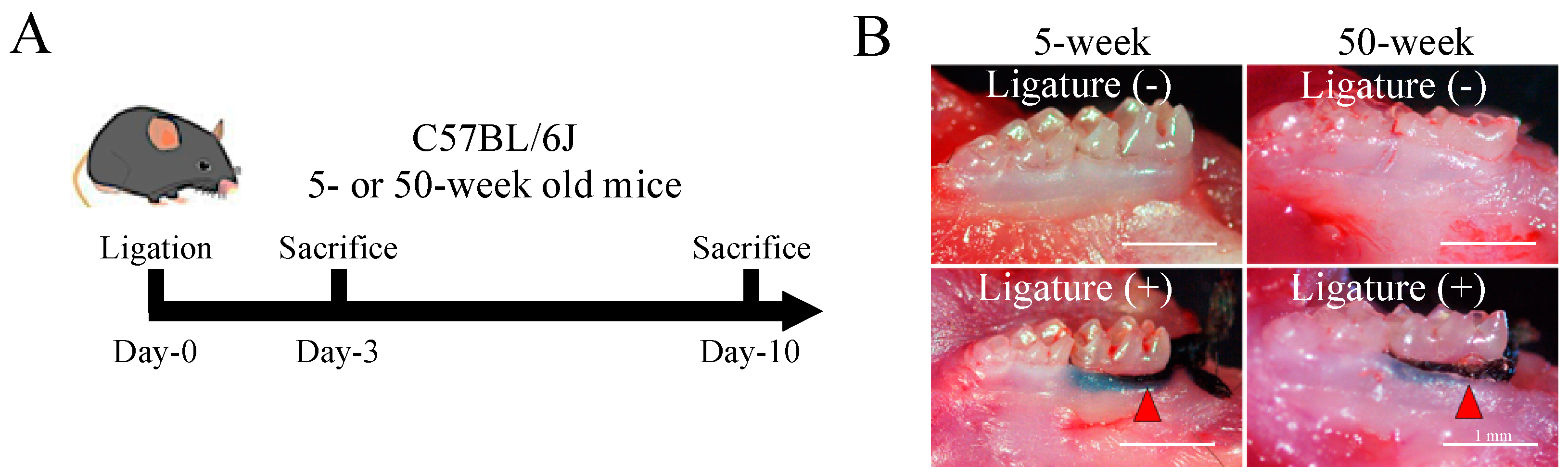 Aging-Affected MSC Functions and Severity of Periodontal Tissue ...