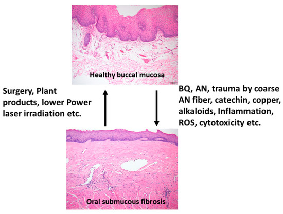 Genetic Susceptibility and Protein Expression of Extracellular Matrix ...
