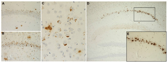 Neuron Loss in Alzheimer’s Disease: Translation in Transgenic Mouse Models