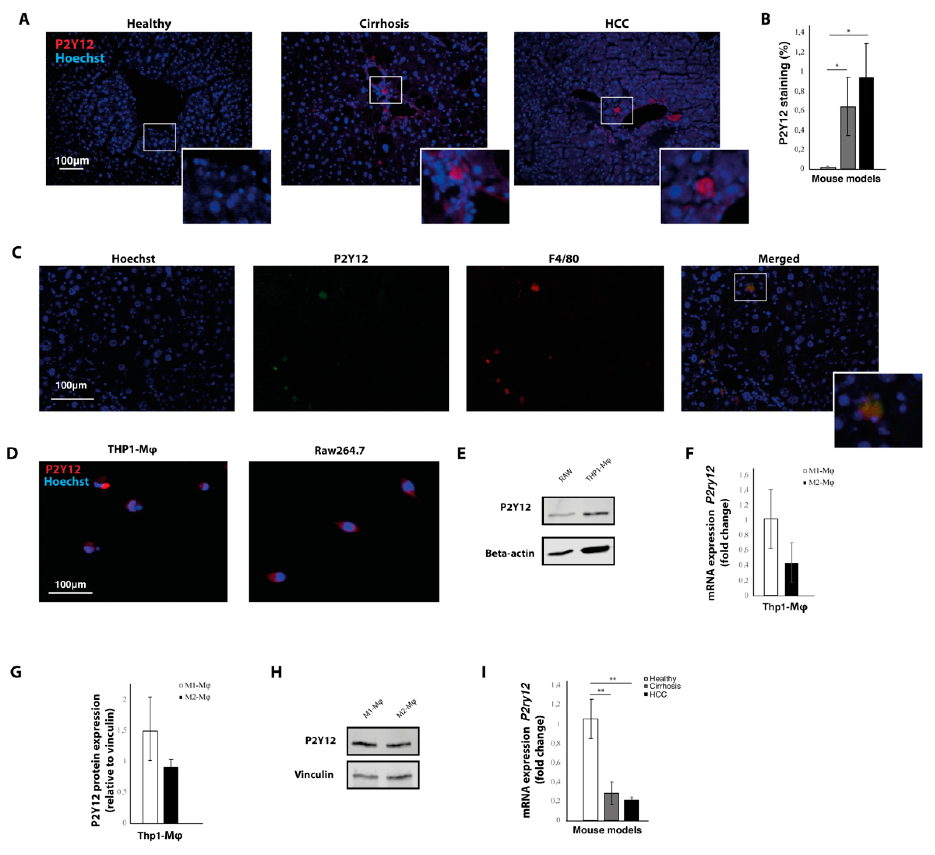 Inhibiting P2Y12 in Macrophages Induces Endoplasmic Reticulum Stress ...