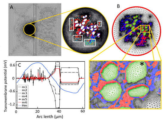 Neural Tissue Degeneration in Rosenthal’s Canal and Its Impact on ...
