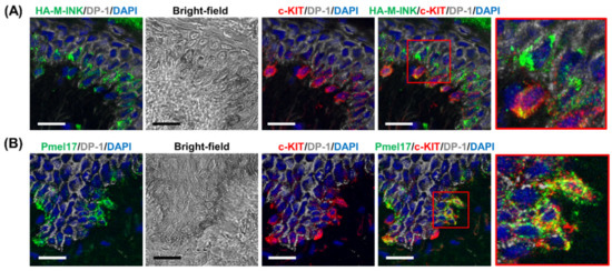 A Novel Method for Visualizing Melanosome and Melanin Distribution in ...