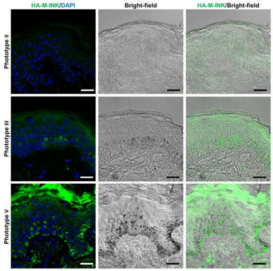 A Novel Method for Visualizing Melanosome and Melanin Distribution in ...