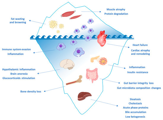 Cachexia, a Systemic Disease beyond Muscle Atrophy