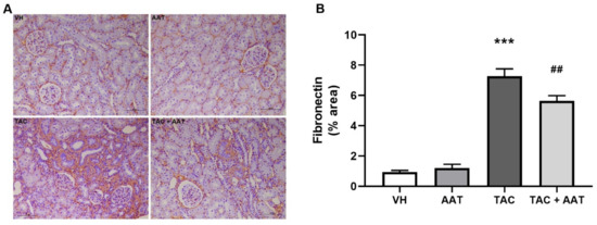 Renoprotective Effects of Alpha-1 Antitrypsin against Tacrolimus ...
